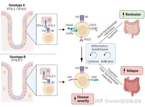 Science Ibd