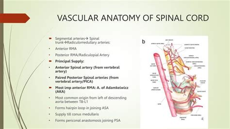 Spinal Cord Vascular Syndromepptx