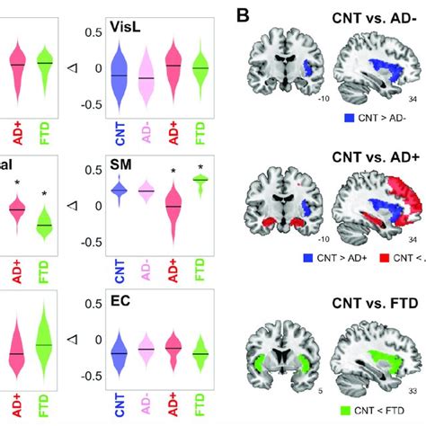 Changes In Dynamical Stability Underlie Differences In Whole Brain