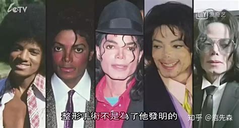 鼻翼缩小手术需要注意些什么 知乎