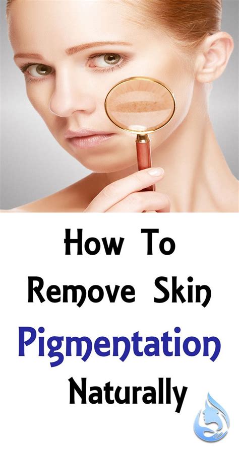 How To Remove Skin Pigmentation Naturally Artofit