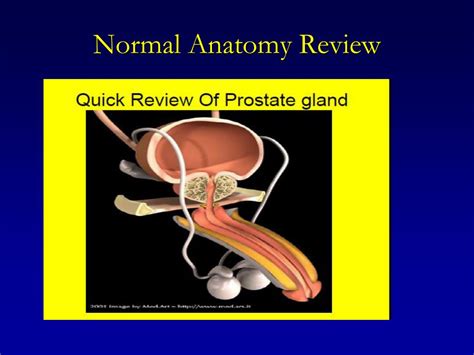 Ppt Pathology Of Prostate Gland Powerpoint Presentation Free