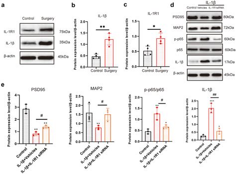Downregulation Of Il 1r1 Expression Alleviated Neuronal Defects Induced