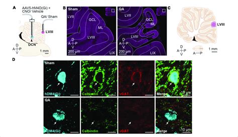 Deep Cerebellar Nuclei Dcn Effect Of Sham And Quinolinic Acid