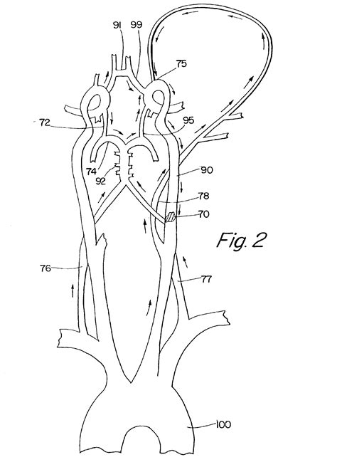 Flow Augmentation Patented Technology Retrieval Search Results Eureka