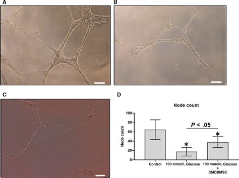 Huvec Tubule Formation In Presence Of Glucose And Dbmscs After