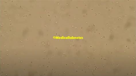 Pantoea Introduction Classification Morphology Pathogenicity