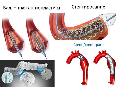 Основы кардиоваскулярной хирургии - презентация онлайн