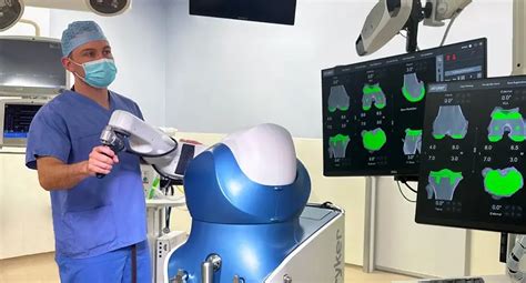 Mako Smart Robotics Total Knee Replacement