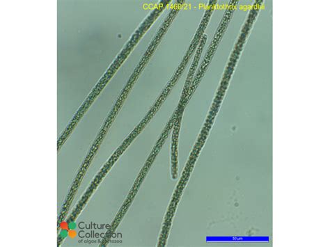 Planktothrix Agardhii