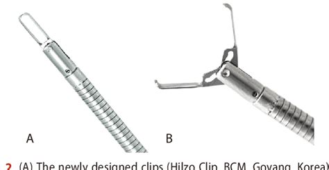 Figure 2 From Clinical Impact Of Prophylactic Endoscopic Clipping For Prevention Of Delayed