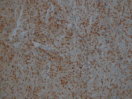 Multiple Scalp Nodules Download Scientific Diagram