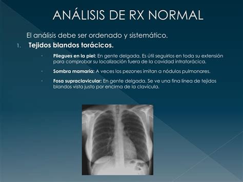 PPT RADIOLOGÍA TORÁCICA PowerPoint Presentation free download ID