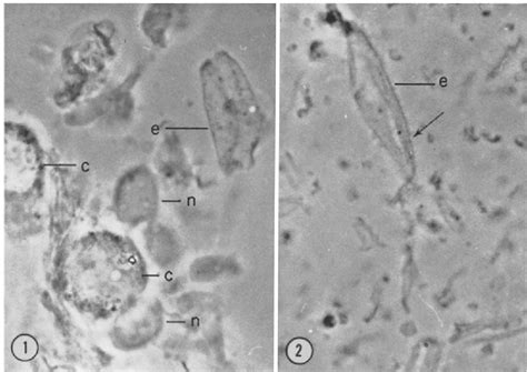Figure From The Isolation Of The Membrane Of The Toad Bladder