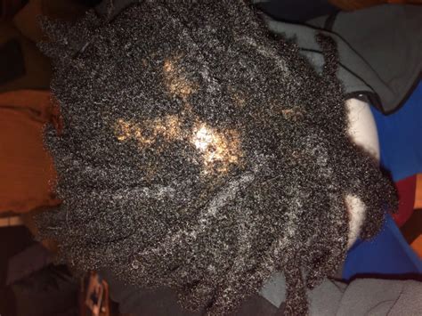 Holistic Scalp Cream 12oz Blackhairandskincare