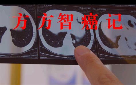 肺癌果酱色痰的图片肺癌血痰图片 伤感说说吧