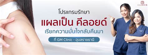 Keloid Scars Gm Clinic