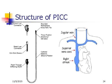 What Gauge Is A Double Lumen Picc Line At Thomas Castillo Blog