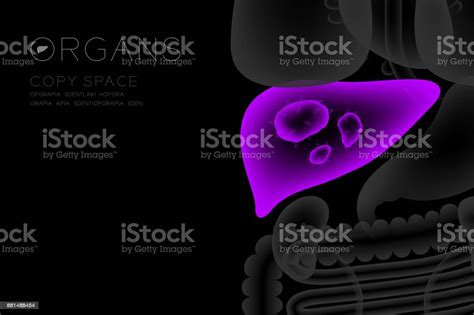 인간의 장기 X 선 세트 간 감염 개념 아이디어 보라색 컬러 일러스트 절연 기관 텍스트 아이콘 및 복사 공간 어두운 배경에서 빛 0명에 대한 스톡 벡터 아트 및 기타 이미지