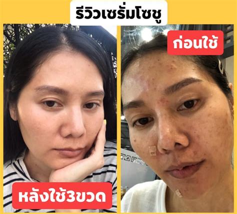 เซรั่มโซชู โลชั่นโซลชู โลชั่นผิวขาว Byปุ๋ยรายใหญ่โซลชู