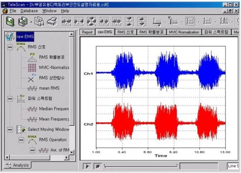 근전도emg Electromyogram 개요 주락싸
