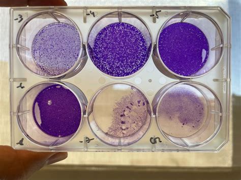 159 Questions With Answers In Plaque Assay Scientific Method