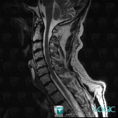 Radiology Case CPPD CT MRI Diagnologic