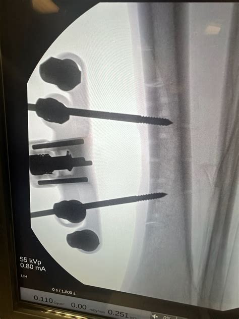 Diabetic Foot Ulcers Valley Foot And Ankle Specialty Providers