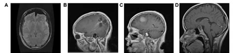 Figure 1 From Explanation Driven Deep Learning Model For Prediction Of