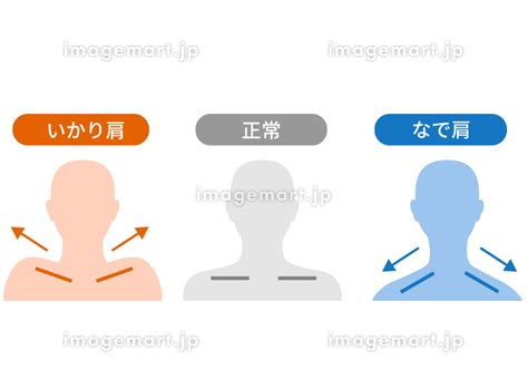 いかり肩となで肩の違いのイラスト素材 212744966 イメージマート