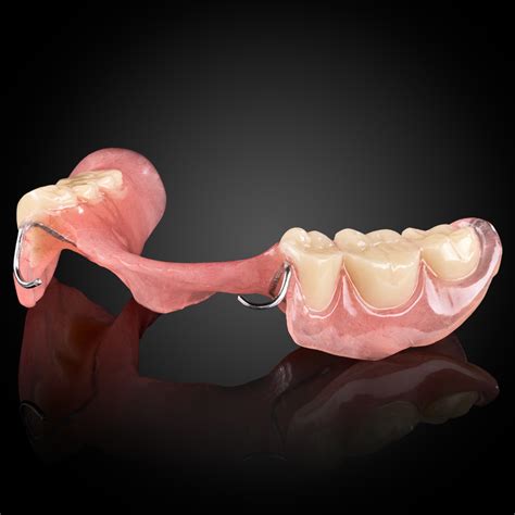 Acrylic Partial Denture Xdent Lab