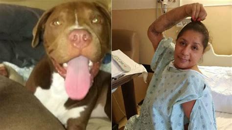 Florida Woman Survives Vicious 9 Minute Attack By Her Own Pit Bull