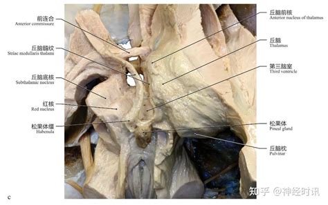 脑干的内部解剖、表面解剖（内附详细标注解剖图） 知乎