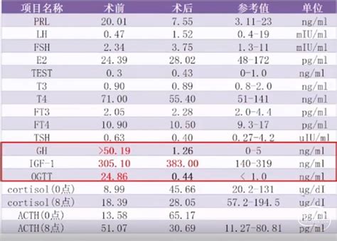 衡立君教授：侵袭海绵窦垂体神经内分泌肿瘤内镜手术技术 脑医汇 神外资讯 神介资讯
