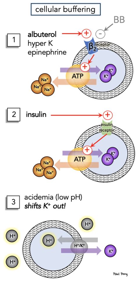 Hyperkalemia Physiology Sinai Em
