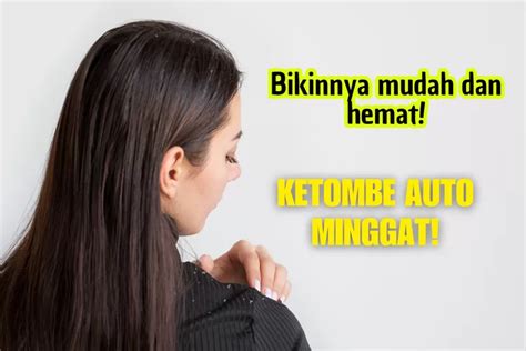 Tips Ampuh Rahasia Hilangkan Ketombe Cukup Pakai 2 Bahan Alami Ini Yang Ada Di Dapur Rambut