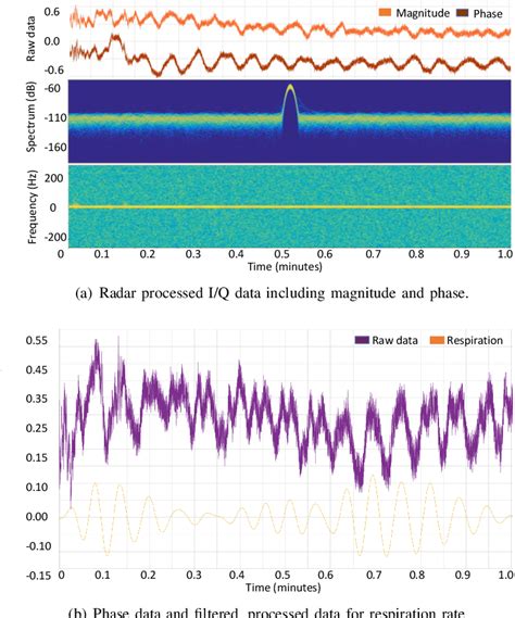 figure 1 from contactless respiration variability detection and
