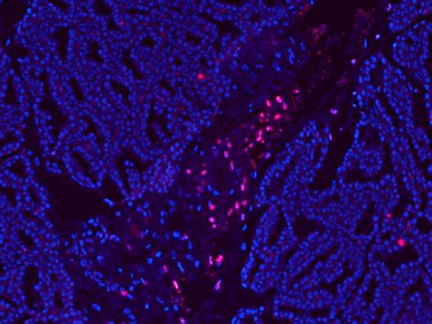 Biotin 20 Dutp Biotium Protein Linking And Labeling Systems