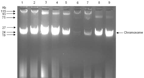Agarose 1 Gel Electrophoresis Of Plasmid Dna From Escherichia