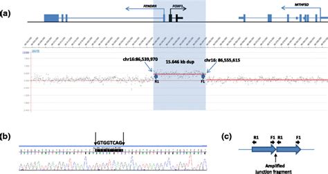 Results Of Acgh And Dna Sequence Analyses In Patient 1 A Acgh Plot