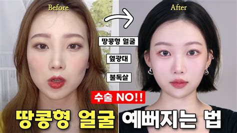 수술 없이 광대 소멸 땅콩형 얼굴 없애는 셀프 경락 마사지🔥 얼굴 작아지는 방법 ️ 땅콩형 얼굴 시술 볼패임 옆광대