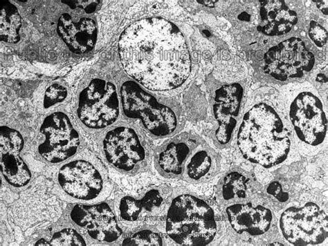 Lymphknoten Drjastrows Em Atlas