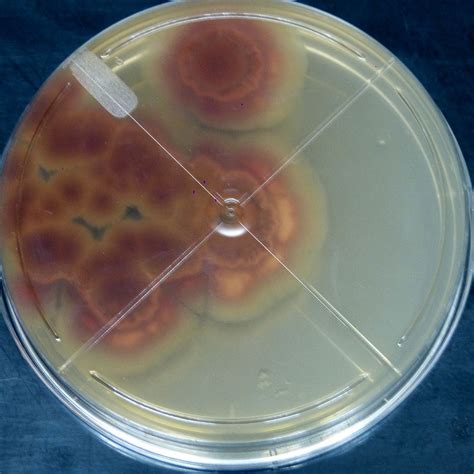 Microbial And Algal Culture Collection Uplb Museum Of Natural History