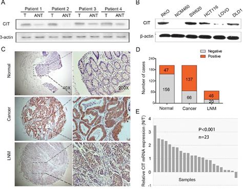 Oncotarget Up Regulation Of Cit Promotes The Growth Of Colon Cancer Cells