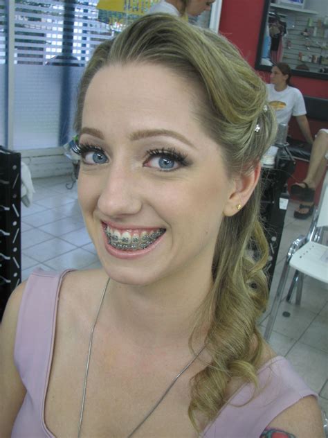 Great Braces Smile Orthodontie Appareil Dentaire Dentaire