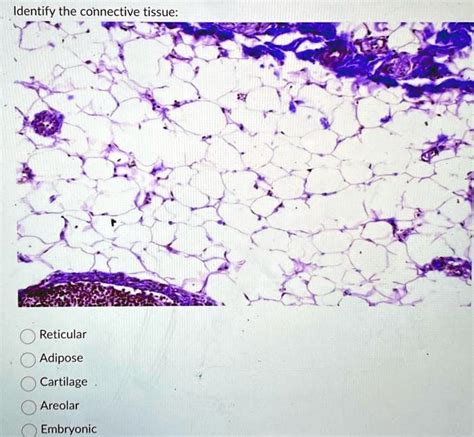Solved Identify The Connective Tissue Reticular Adipose Cartilage Areolar Embryonic Identify