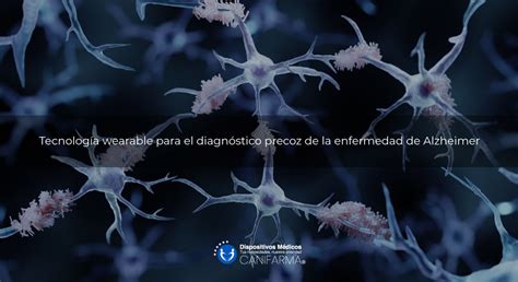 Tecnología Wearable Para El Diagnóstico Precoz De La Enfermedad De