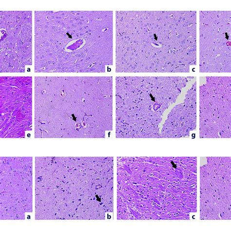 Pdf The Construction Of A Radiation Induced Brain Injury Model And