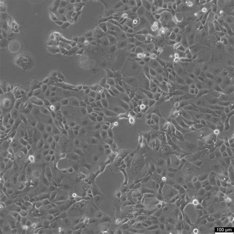 Hcc78 Cells