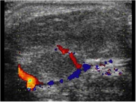 Musculoskeletal Joints And Tendons 63 Wrist And Carpus Case 639